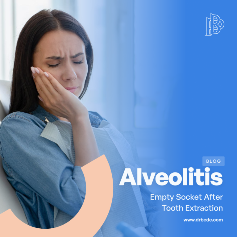 Alveolitis: Empty Socket After Tooth Extraction | Dr Bede
